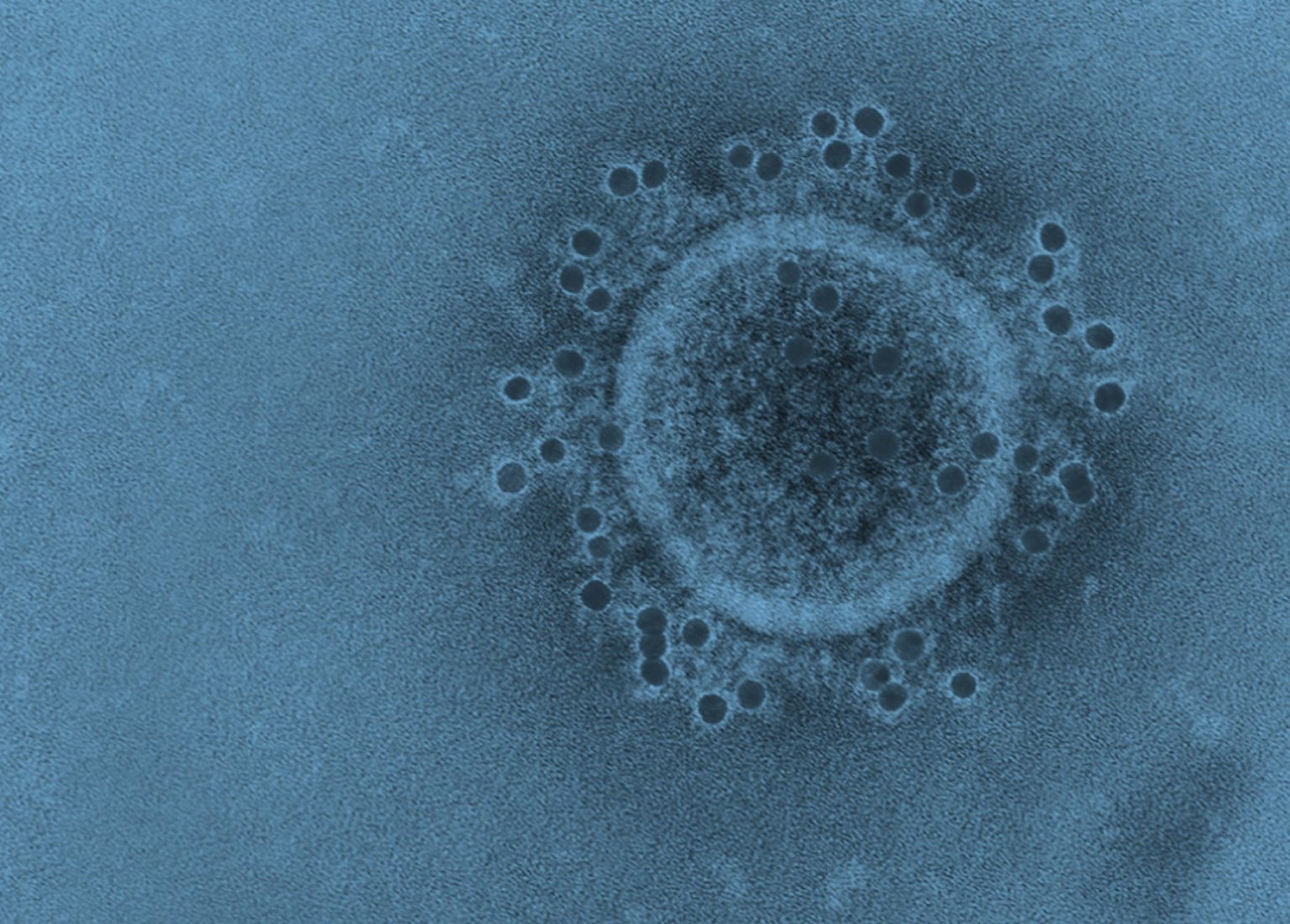 Coronavirus Response: United States | International Medical Corps